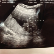 Sentara Careplex Hospital 3000 Coliseum Dr, Hampton, VA 23666 ...